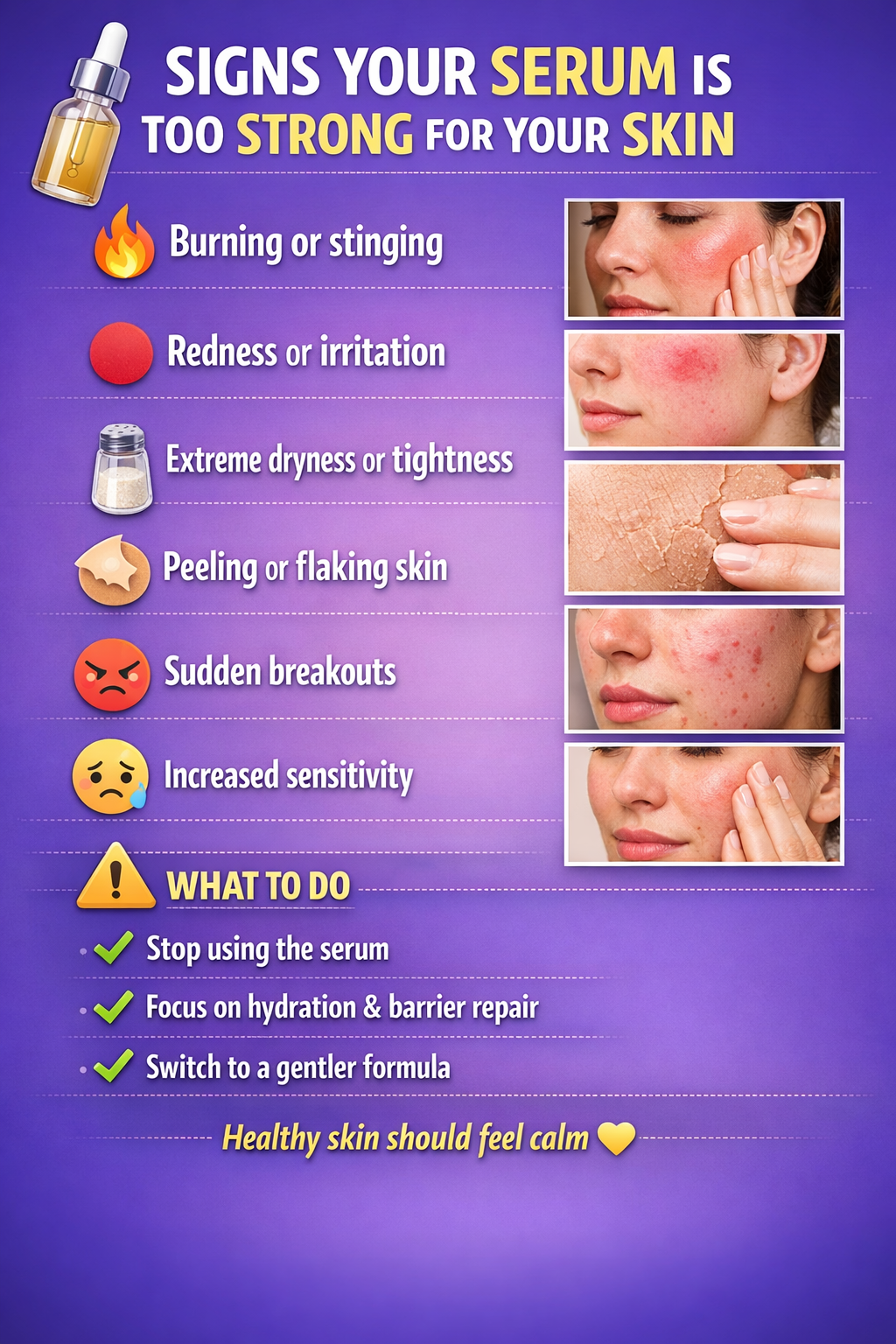 Signs Your Serum Is Too Strong for Your Skin – Hollyberry Cosmetics UK